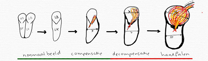 Mitraalkleppen - Dierenarts Jonker
