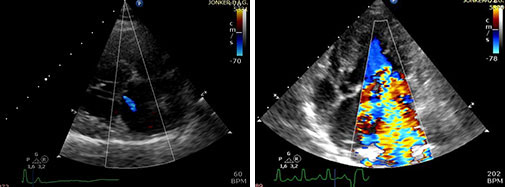 Mitraalkleppen - Dierenarts Jonker