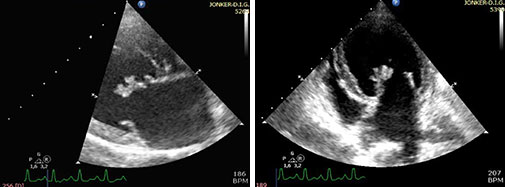 Mitraalkleppen - Dierenarts Jonker